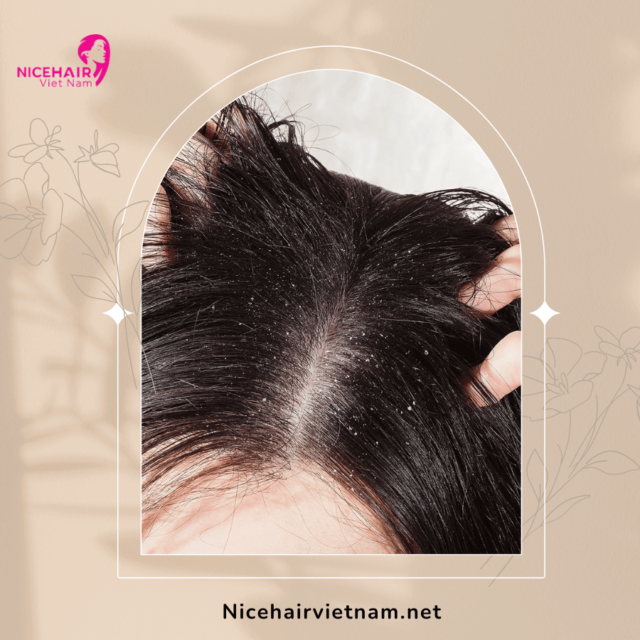 Do you understand how the aging process of our scalp works?